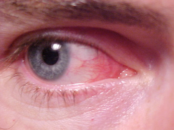 Optometric Management | PentaVision