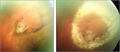 Optometric Management | PentaVision