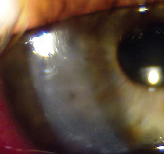 Optometric Management | PentaVision