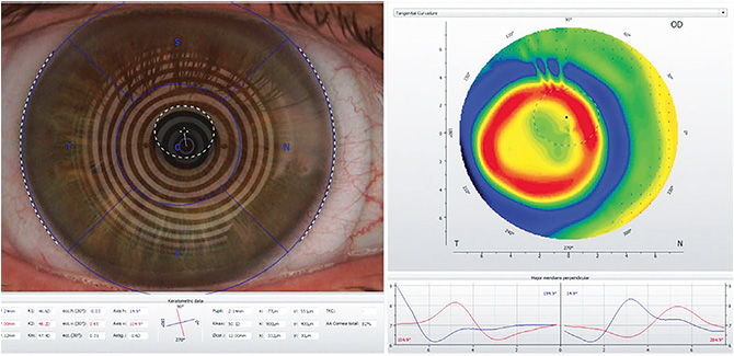 Optometric Management | PentaVision
