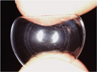 Optometric Management | PentaVision
