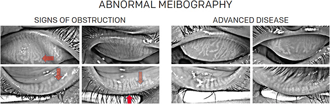 Optometric Management | PentaVision