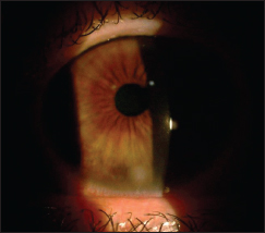 Optometric Management | PentaVision