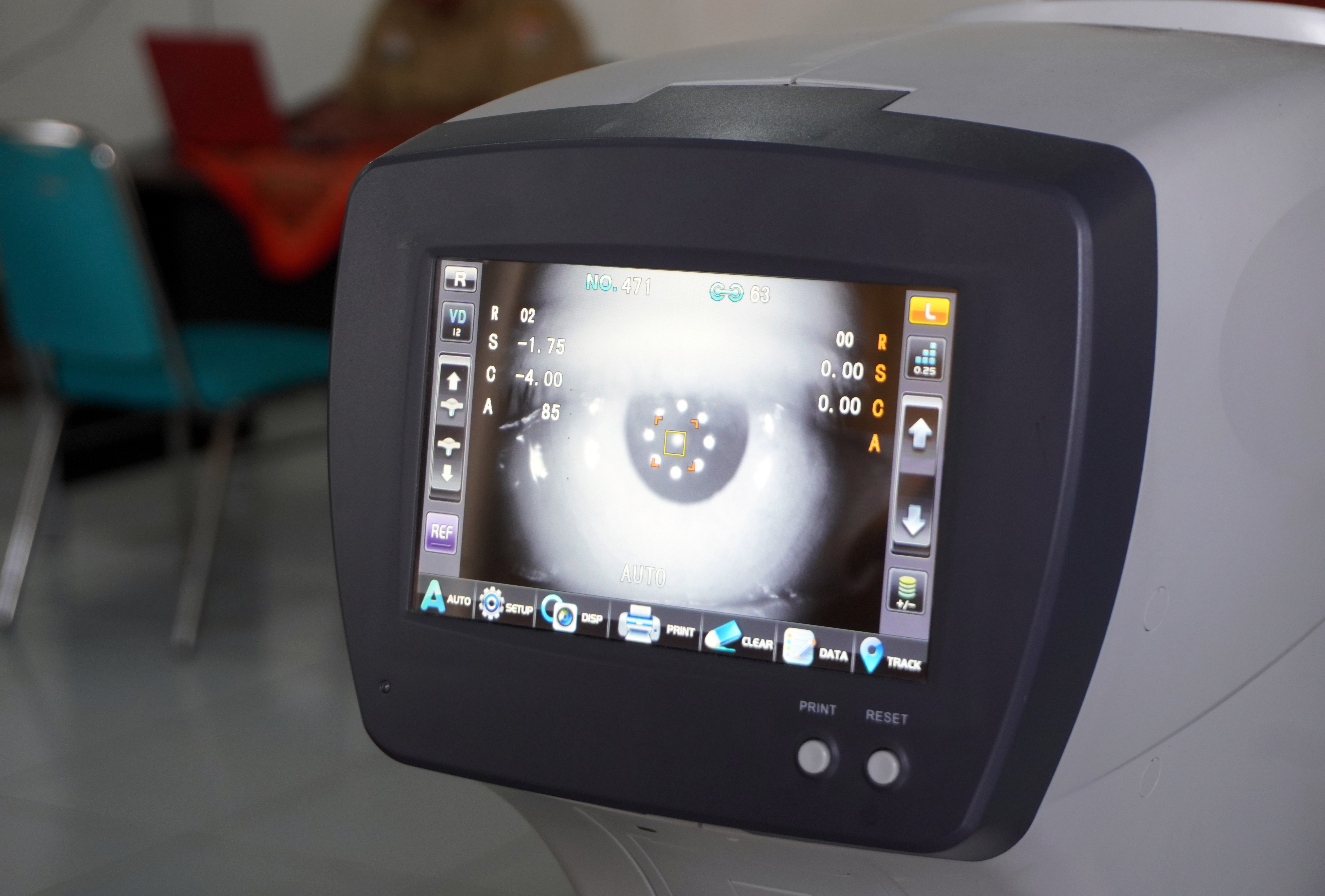 The Relationship of Tear Film Instability and Higher-Order Aberrations ...