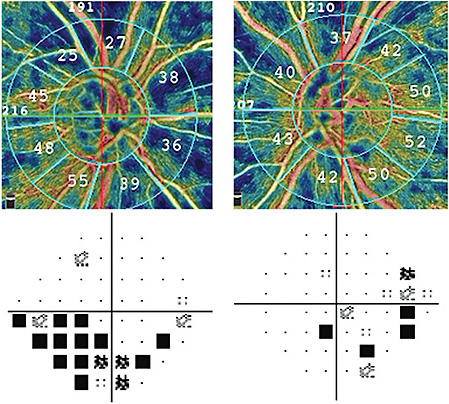 Optometric Management | PentaVision
