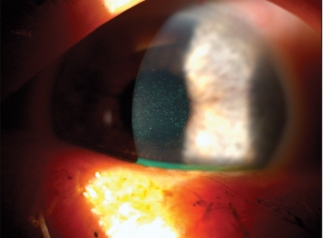 Optometric Management | PentaVision