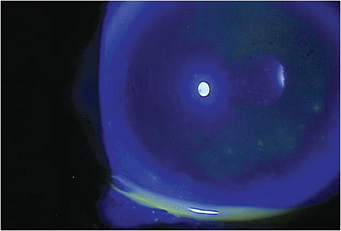 Optometric Management | PentaVision