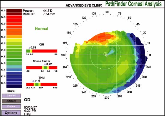 Optometric Management | PentaVision