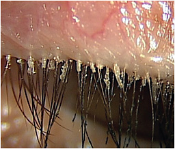 Optometric Management | PentaVision