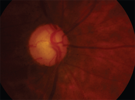 Optometric Management | PentaVision