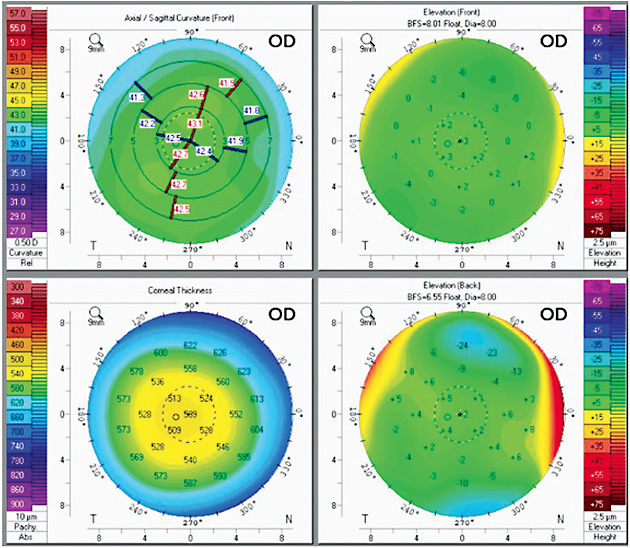 Optometric Management | PentaVision