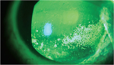 Optometric Management | PentaVision