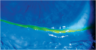 Optometric Management | PentaVision