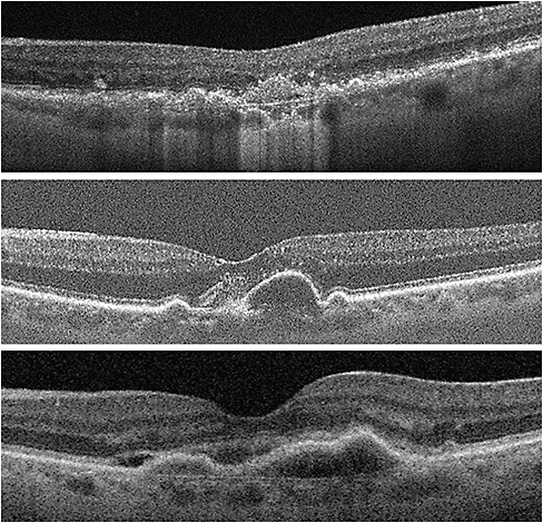 Optometric Management | PentaVision