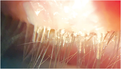 Optometric Management | PentaVision