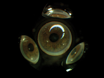 Optometric Management | PentaVision