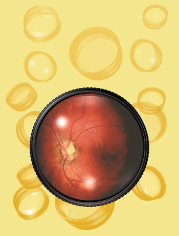 Optometric Management | PentaVision