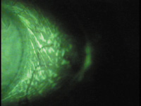 Optometric Management | PentaVision