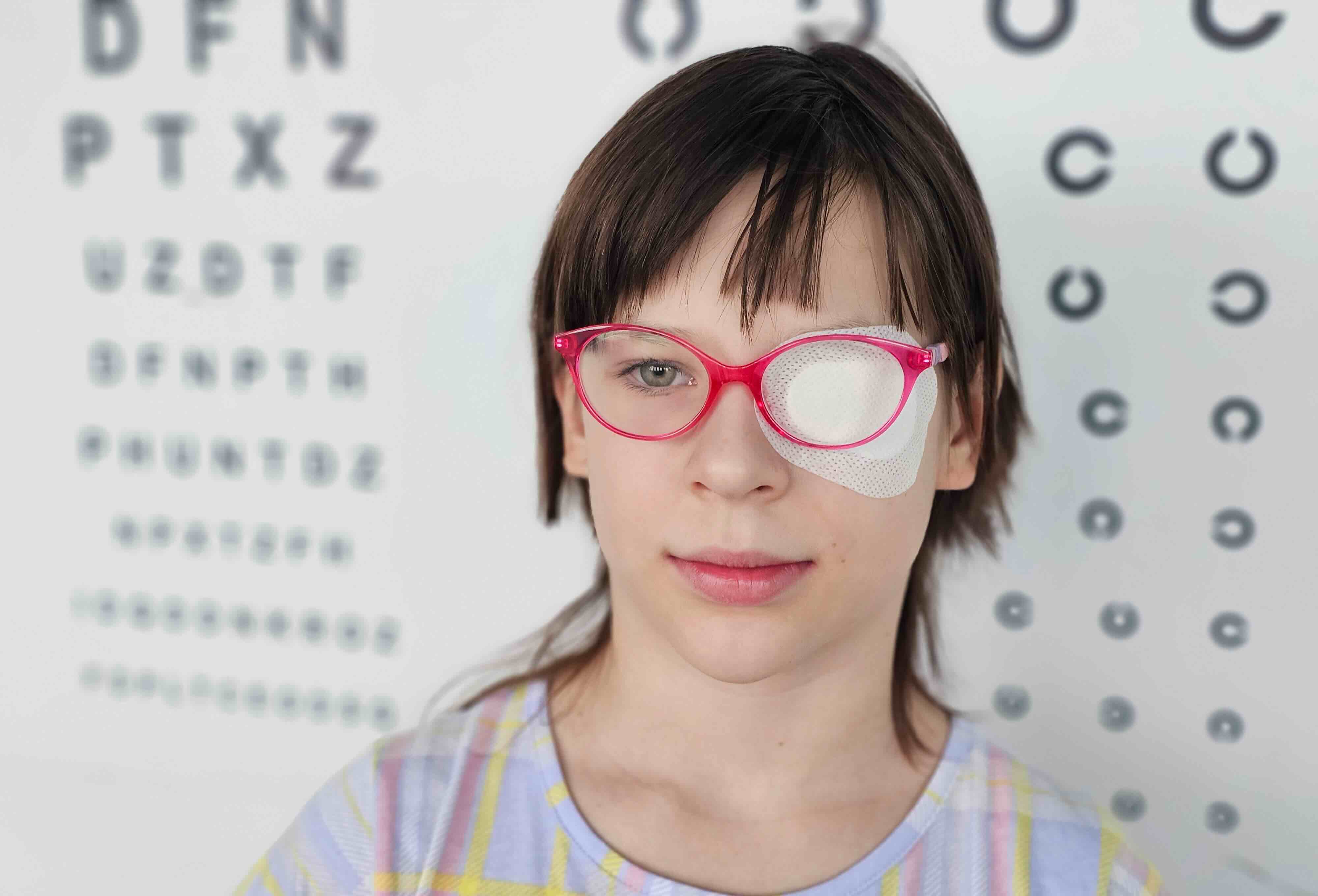 Amblyopia Treatment Extends Past Preschool Years | Optometric Management