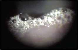Optometric Management | PentaVision