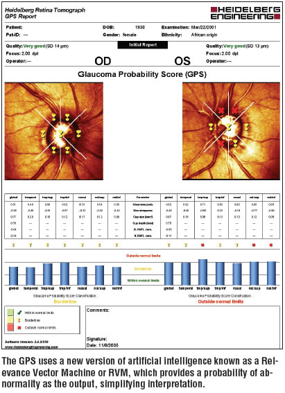 Optometric Management | PentaVision