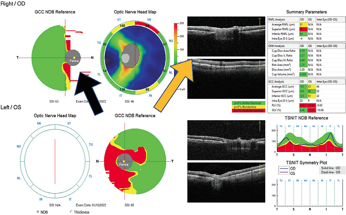 Optometric Management | PentaVision