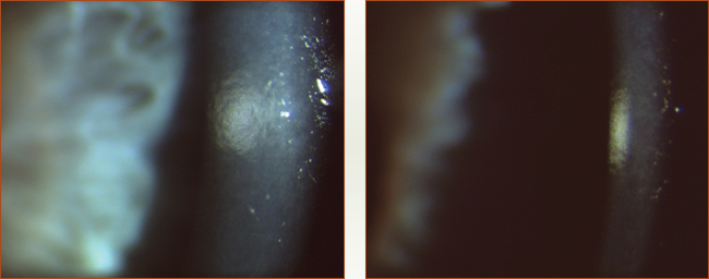 Optometric Management | PentaVision