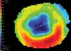 Optometric Management | PentaVision