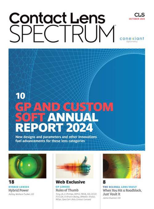Prepare for the New Contact Lens Rule | Optometric Management