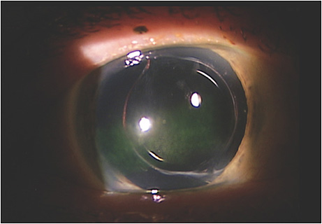 Optometric Management | PentaVision