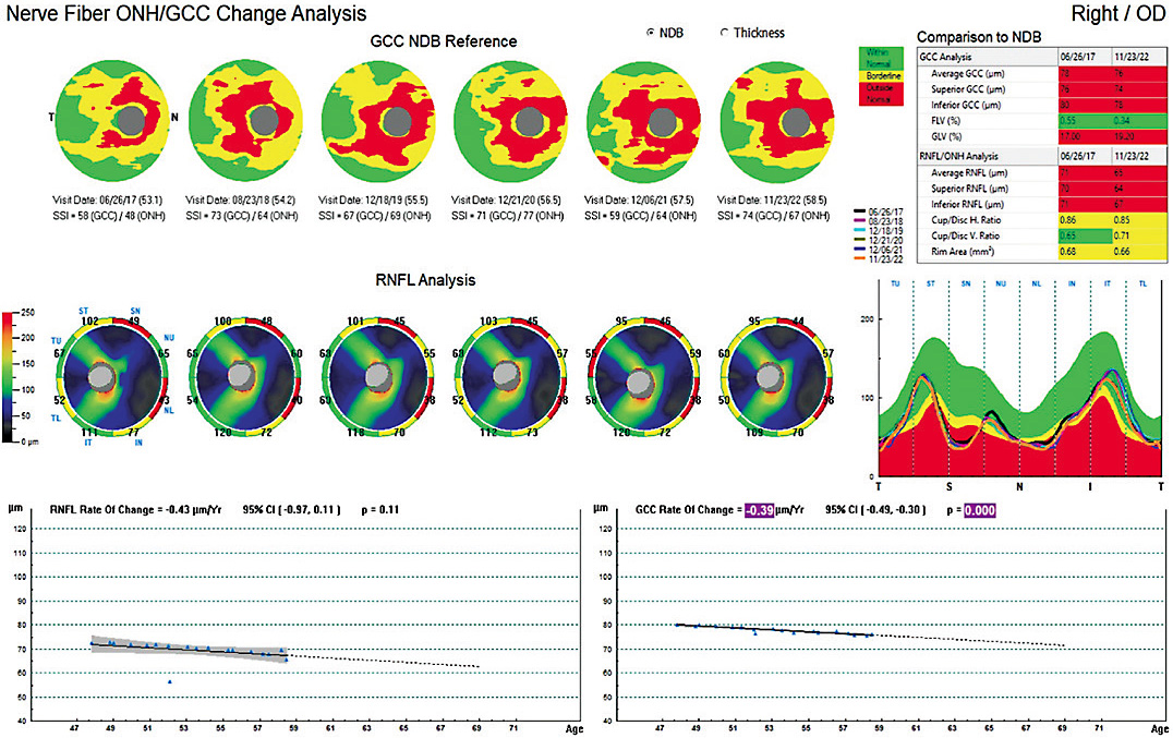 Optometric Management | PentaVision
