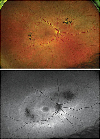 Optometric Management | PentaVision