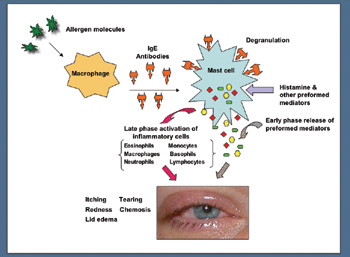 Optometric Management | PentaVision
