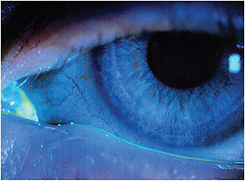 Optometric Management | PentaVision