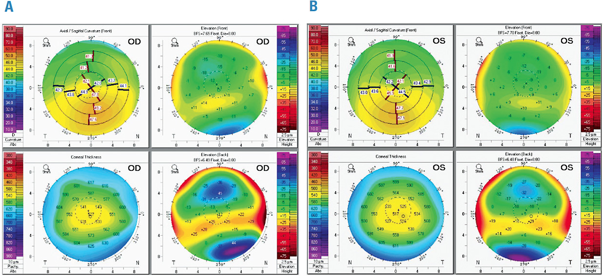 Optometric Management | PentaVision