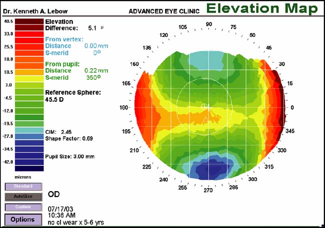 Optometric Management | PentaVision
