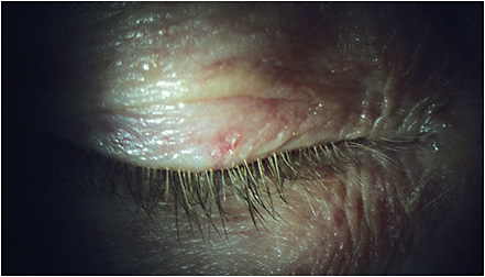Optometric Management | PentaVision