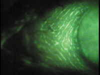 Optometric Management | PentaVision